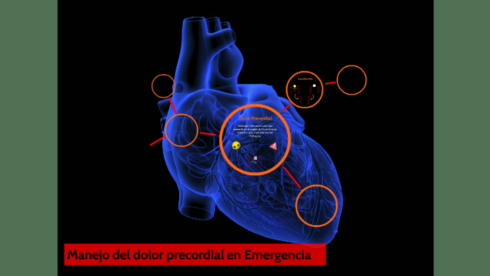 Manejo del dolor precordial en Emergencia by rosmery valles