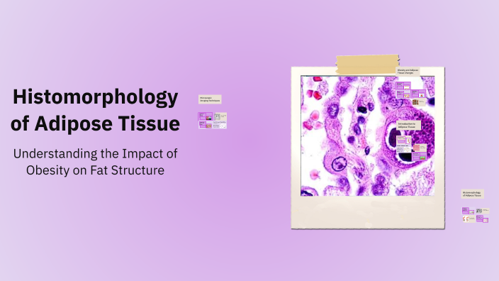 Histomorphology of Adipose Tissue by Anita Bishnoi on Prezi