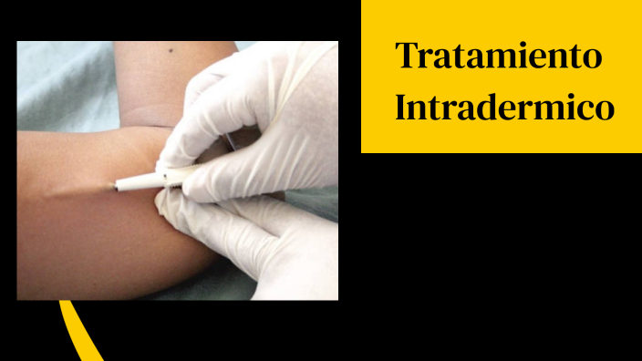 Intradermico by Félix LHB on Prezi