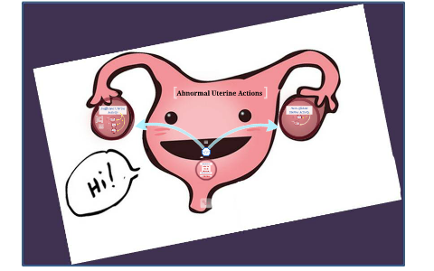 Abnormal Uterine Actions by SnSn Al-Jawi on Prezi