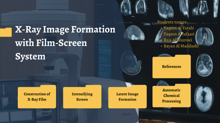 X-Ray Image Formation with Film-Screen System by Raja Almazroei on Prezi