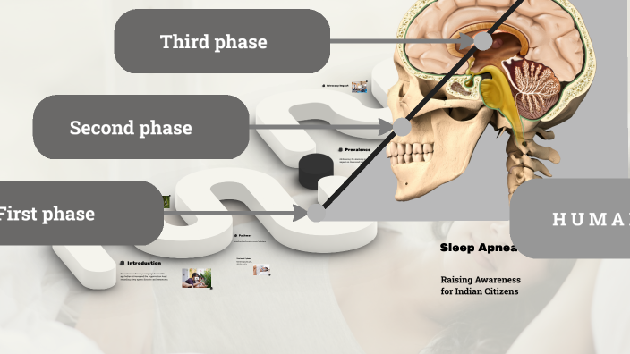 Sleep Apnea Advocacy Campaign by Gunn Sharma on Prezi