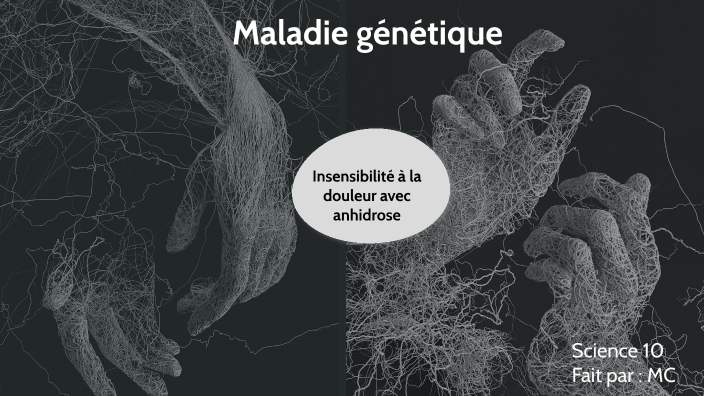 Insensibilité à la douleur avec anhidrose by M̸C̸ on Prezi