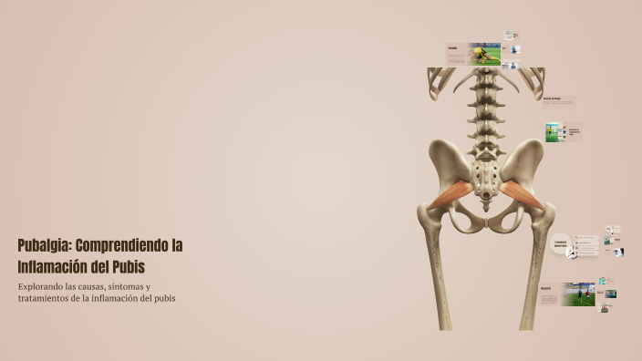 Pubalgia: Comprendiendo la Inflamación del Pubis by Samariss Durán on Prezi