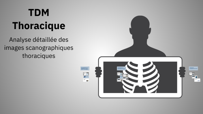 TDM Thoracique by kawtar nafa on Prezi