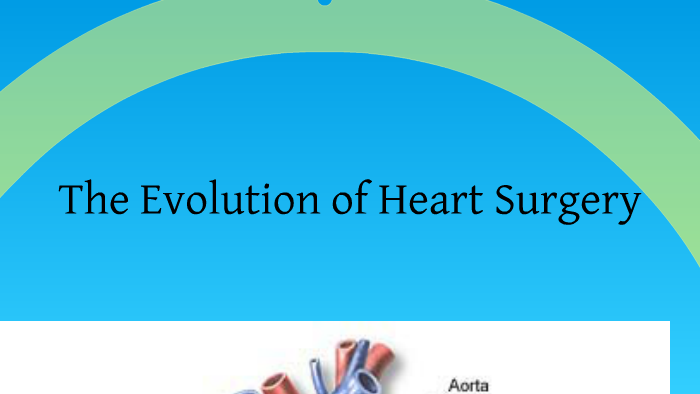 The evolution of Heart surgery by josh doughty on Prezi