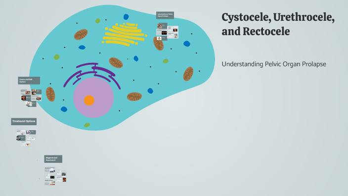 Cystocele, Urethrocele, and Rectocele by shine shaji on Prezi