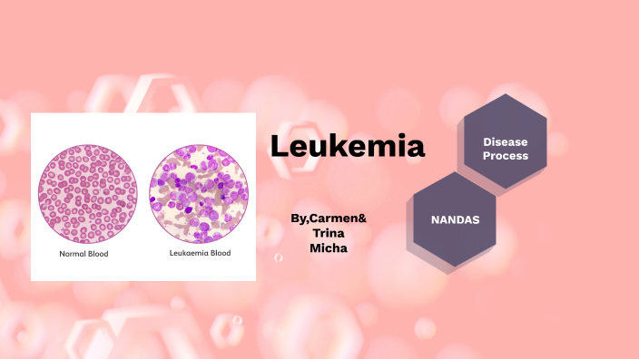 Leukemia Project by carmen butler on Prezi