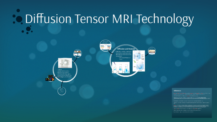Diffusion Tensor MRI Technology by Alexis Van Buren on Prezi