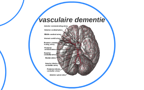 vasculaire dementie by Berendina Kooistra on Prezi