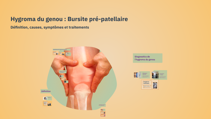 Hygroma du genou : Bursite pré-patellaire by Achille DJAHO on Prezi