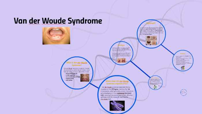 Van der Woude Syndrome by Jerald Whitley on Prezi
