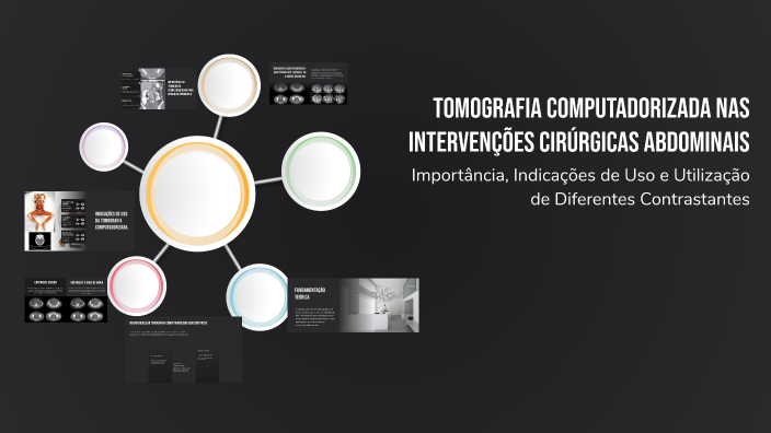 Tomografia Computadorizada nas Intervenções Cirúrgicas Abdominais by ...