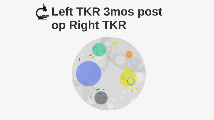 Left TKR 3mos post op Right TKR by Kim Mariotti on Prezi