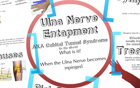 Ulna Nerve Impingement by Charlie Luscombe on Prezi