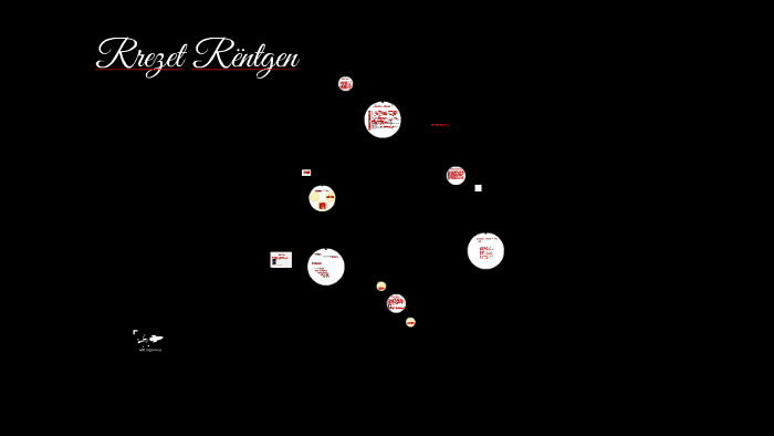 Rrezet Rentgen by Kevin Josifi on Prezi
