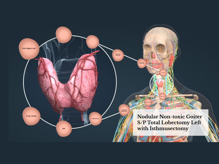 Non-toxic Nodular Goiter by JAYVEE JOSE on Prezi