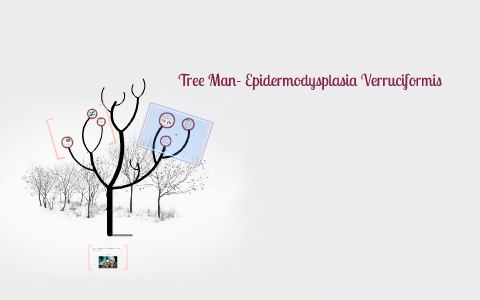 Tree Man- Epidermodysplasia Verruciformis by Tess Lawson