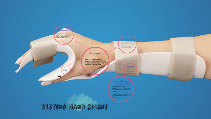 Resting Hand Splint By Thivyaa Asokan On Prezi