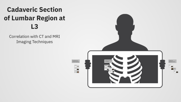 Cadaveric Section of Lumbar Region at L3 by Sandeep Patwa on Prezi