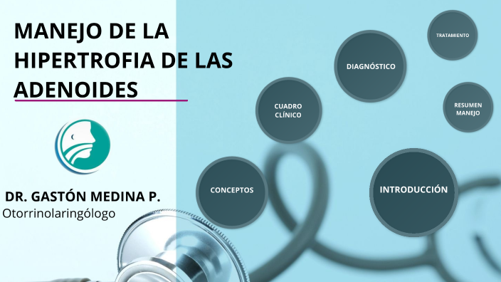 MANEJO DE HIPERTROFIA DE ADENOIDES by Gaston Medina on Prezi