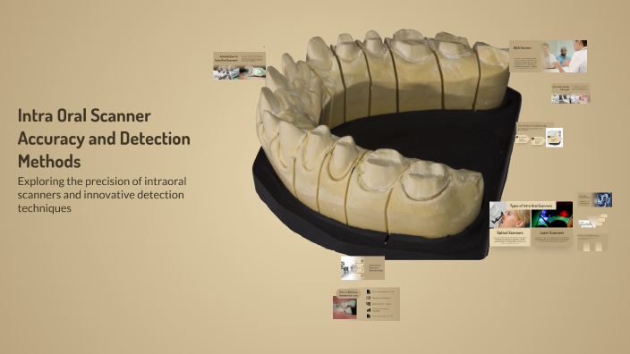 Intra Oral Scanner Accuracy and Detection Methods by gege milad on Prezi