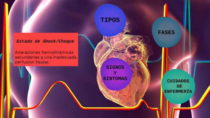 Estados de Choque by Carla Díaz on Prezi