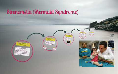 Mermaid Syndrome by Becca Thompson on Prezi