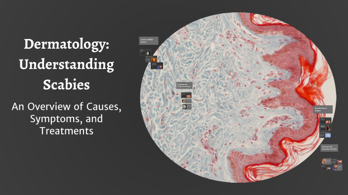 Dermatology: Understanding Scabies by Vincent Böhme on Prezi