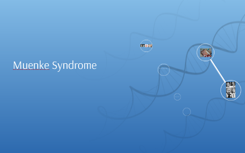 Muenke Syndrome by Casey Shoemaker on Prezi