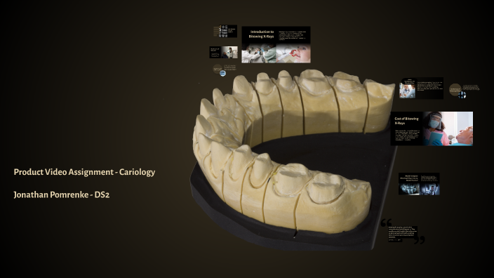 Understanding Bitewing X-Rays in Dentistry by Jonathan Pomrenke on Prezi