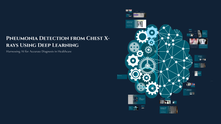 Pneumonia Detection from Chest X-rays Using Deep Learning by Pedro ...