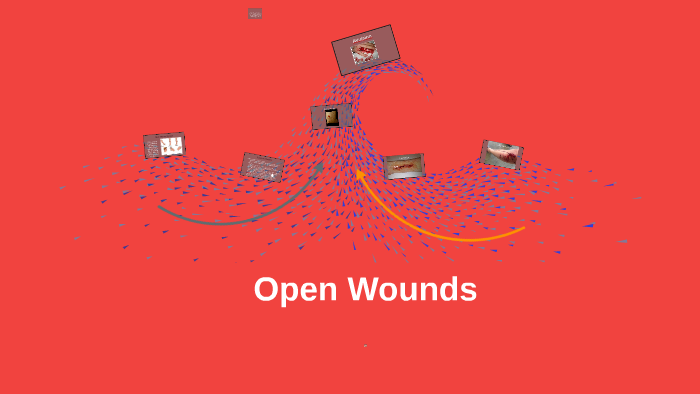 Types of Wounds by on Prezi