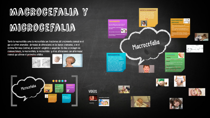 Macrocefalia y Microcefalia by Jorge Mario Alvarez Montoya on Prezi