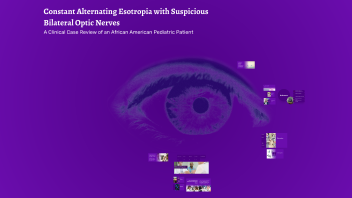 Constant Alternating Esotropia with Suspicious Bilateral Optic Nerves ...