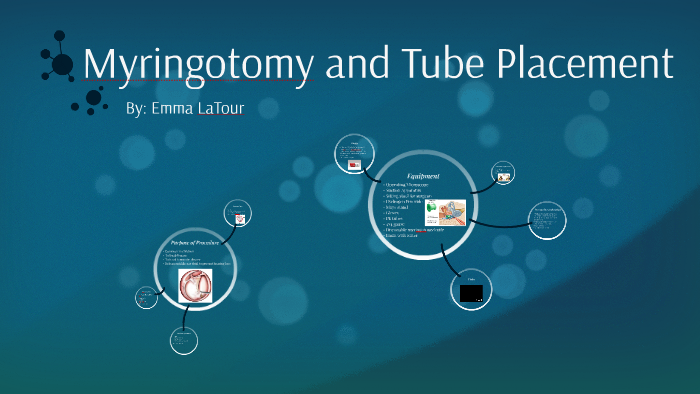 Myringotomy and Tube Placement by Emma LaTour on Prezi