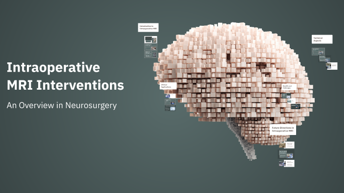 Intraoperative MRI Interventions by Jason HO on Prezi