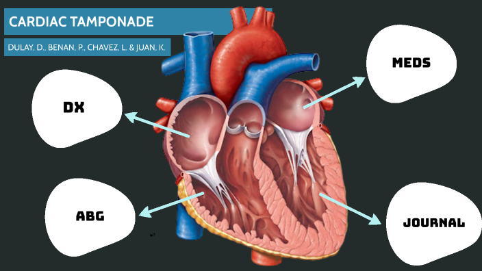 CARDIAC TAMPONADE by Kayla Marie Juan on Prezi