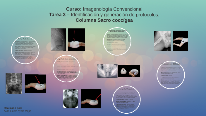 Columna Sacro coccígea by Aura Lizeth Ayala on Prezi