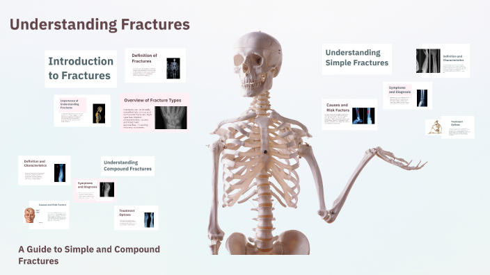 Understanding Fractures by Tashiana Luu on Prezi