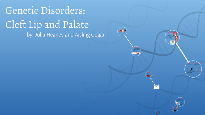 Genetic Disorders: Cleft Lip and Palate by julia heaney on Prezi
