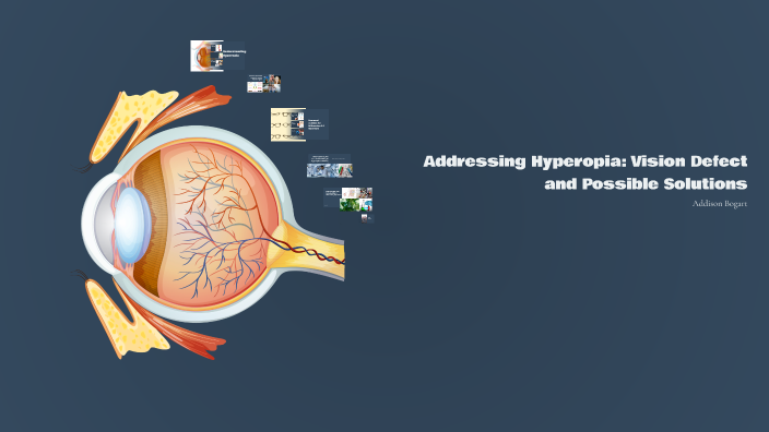 Addressing Hyperopia: Vision Defects and Community Solutions by Addie ...