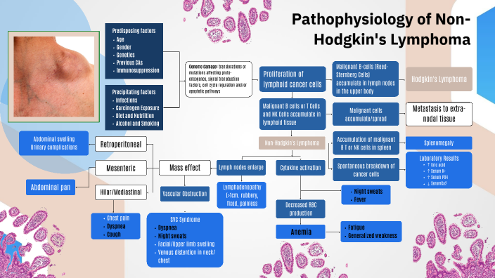 Pathophysiology of NHL by Kim Hope on Prezi