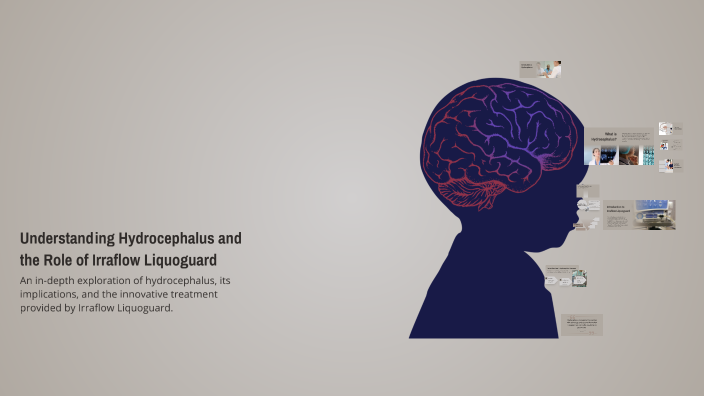 Understanding Hydrocephalus and the Role of Irraflow Liquoguard by ...