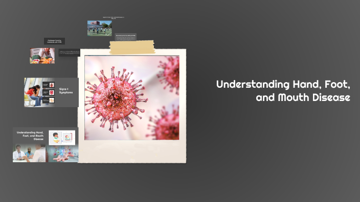 Understanding Hand, Foot, and Mouth Disease by Samantha Williams on Prezi