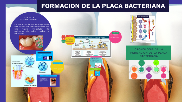 formación de la placa bacteriana by Jeremy Montañez on Prezi