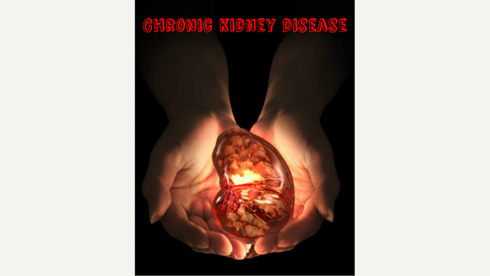 Chronic Kidney Disease Concept Map by Alain Kyle on Prezi