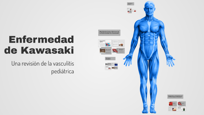 Enfermedad de Kawasaki by YENNY ANGELA FLORES CHAVEZ on Prezi
