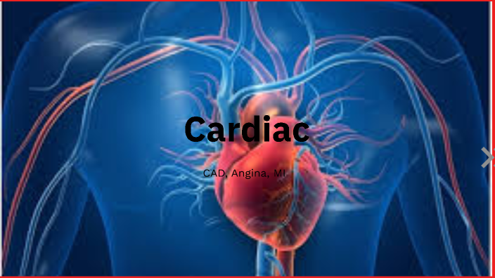 Cardiac (CAD, Angina, MI) by I GZ on Prezi