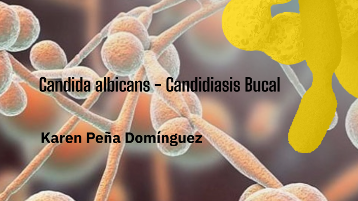 Modelo de Enfermedad de Candidiasis Bucal by Karen Peña on Prezi